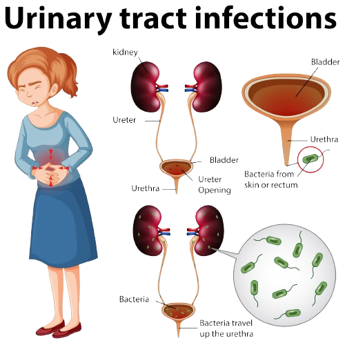Urinary Infection STD treatment - GreenWorld Gresswold